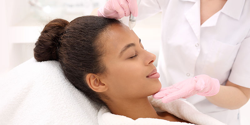 MICRO NEEDLING - Dermatologist in Sandton and Lethabong | Dr Matilda ...